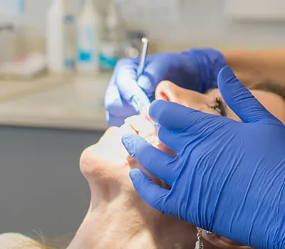 Get a brighter, whiter smile today with Whitening in Chudleigh